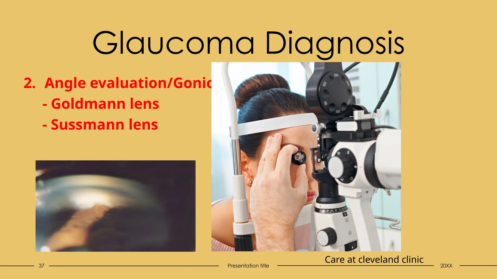 Glaucoma a silent thief of sight, a medical emergency | PPTX