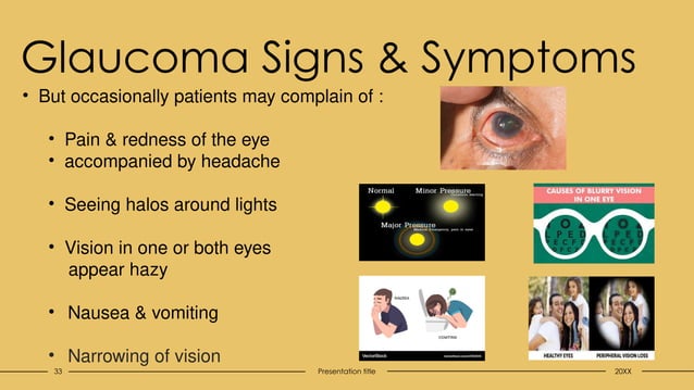 Glaucoma a silent thief of sight, a medical emergency | PPT