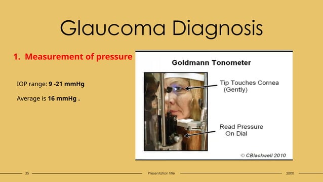Glaucoma a silent thief of sight, a medical emergency | PPT