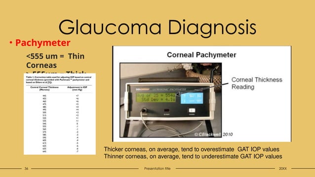Glaucoma a silent thief of sight, a medical emergency | PPT