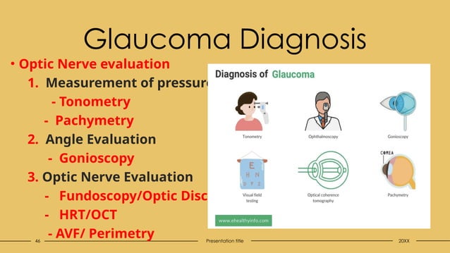 Glaucoma a silent thief of sight, a medical emergency | PPT