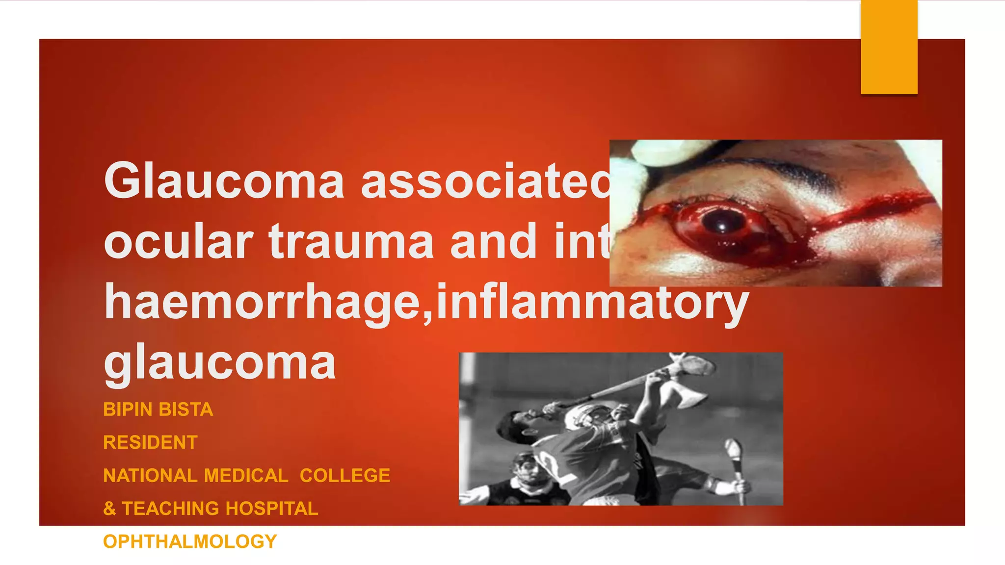 Glaucoma associated with ocular trauma and intraocular haemorrhage ...
