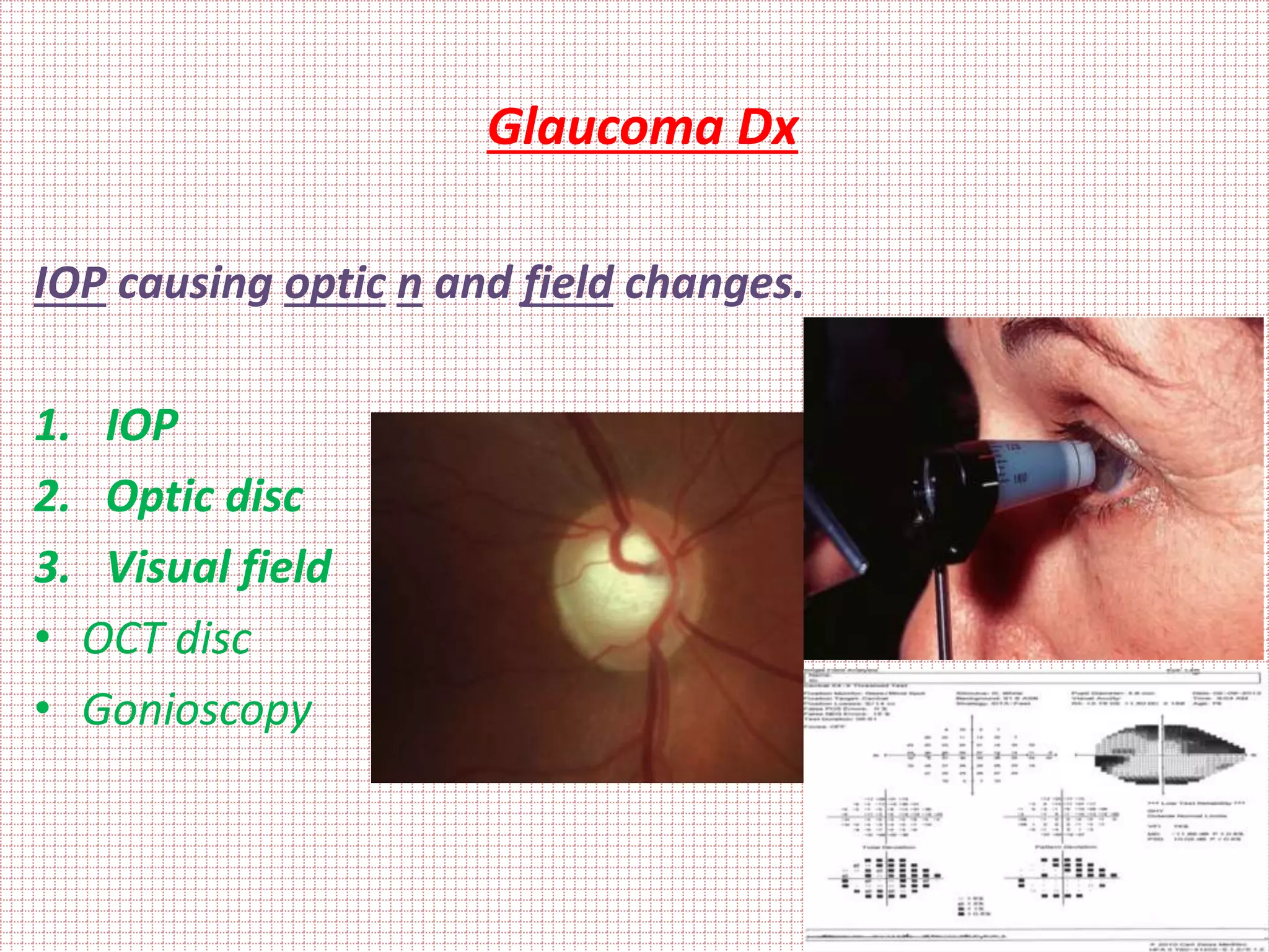 Glaucoma basic principles part 1 | PPTX