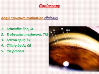Glaucoma basic principles part 1 | PPT