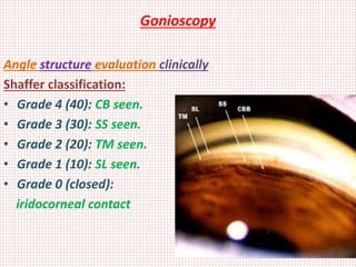 Glaucoma basic principles part 1 | PPT