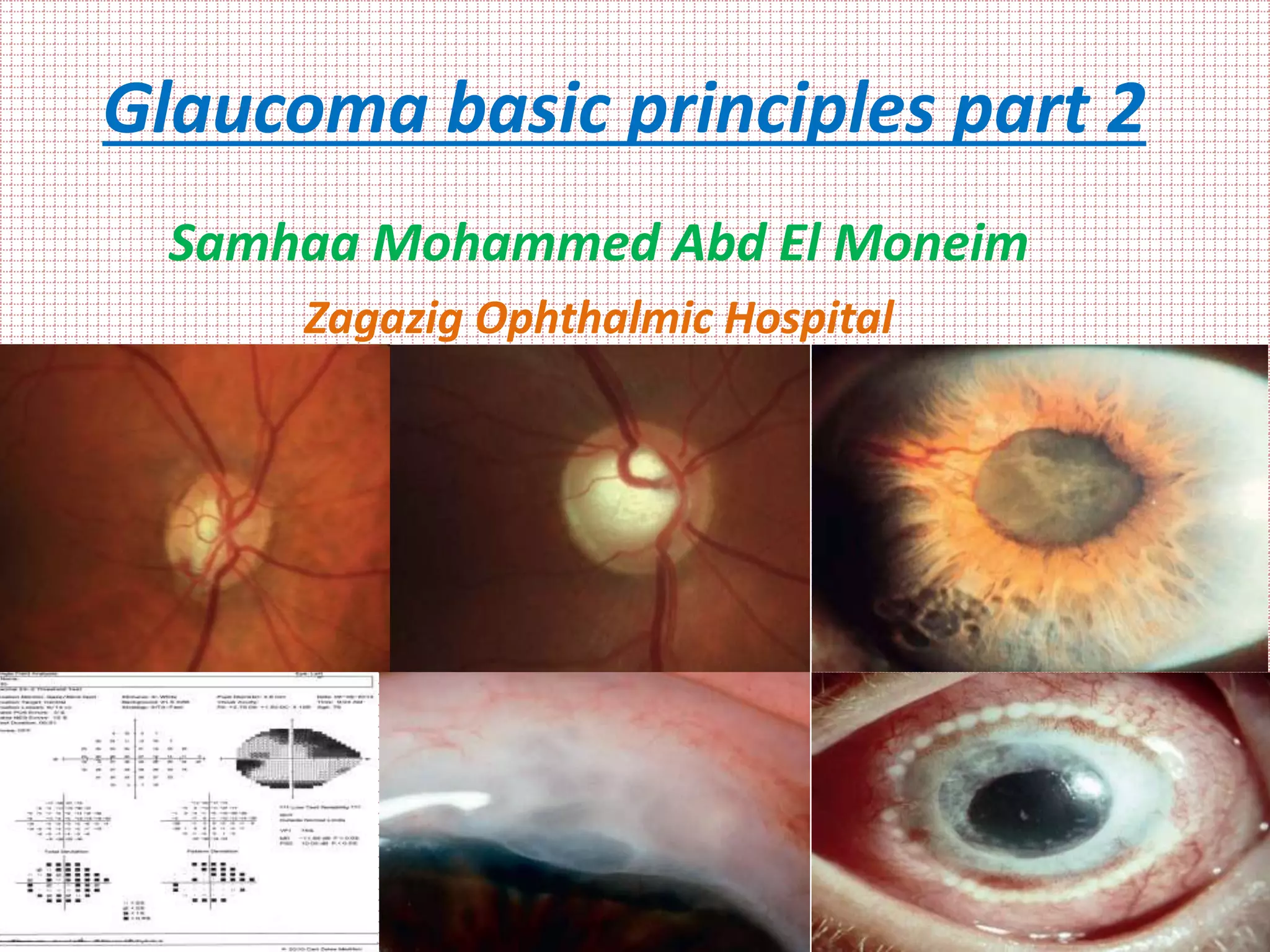Glaucoma basic principles part 2 | PPTX