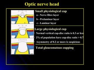 Glaucoma basics and pcg | PPT