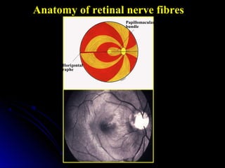 Glaucoma basics and pcg | PPT