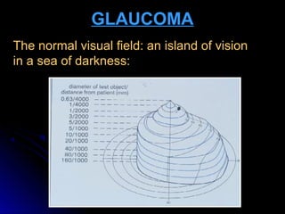 Glaucoma basics and pcg | PPT
