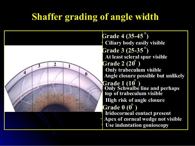 Glaucoma basics and pcg