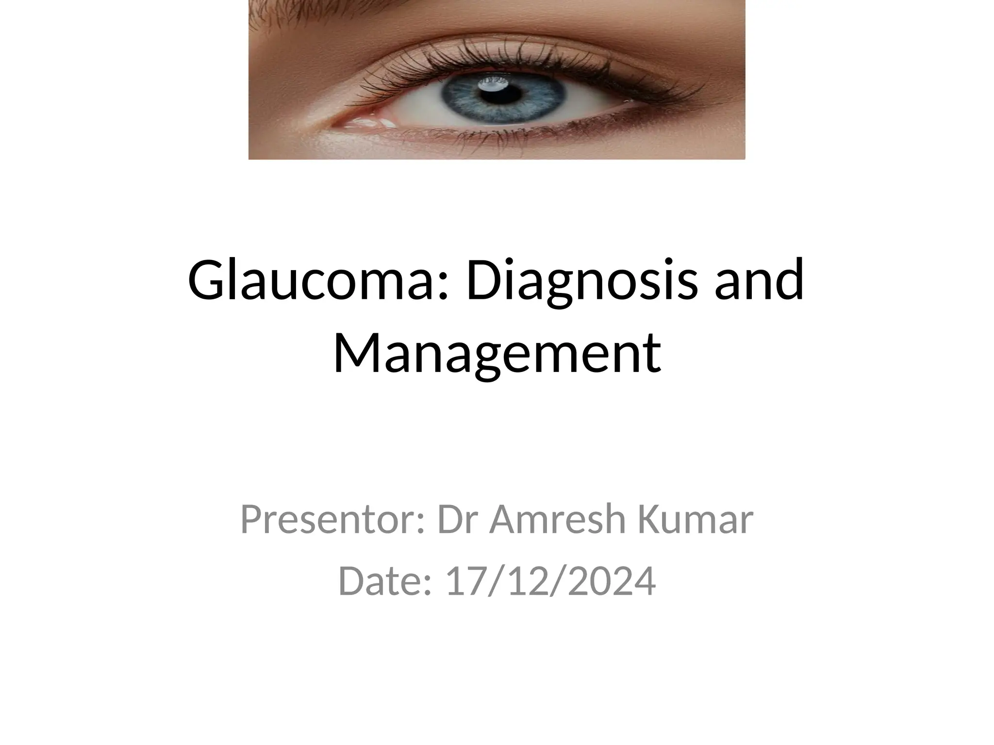 glaucoma definition, clinical features, management.pptx