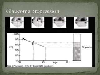 Current Trends in Diagnosis and Management of Glaucoma | PPT