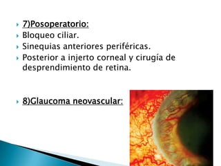Glaucoma de ángulo abierto primario y secundario | PPTX