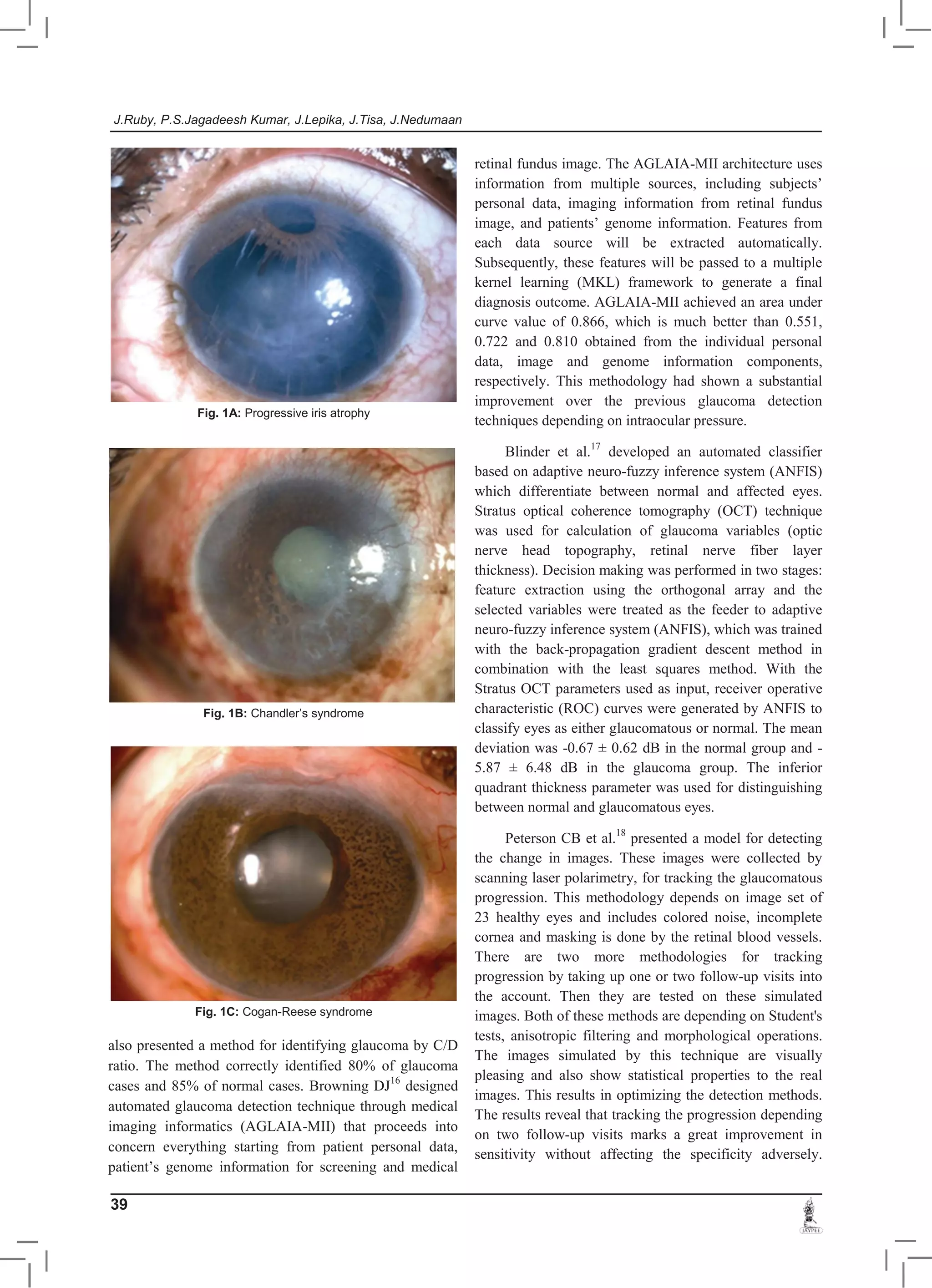 Glaucoma Detection And Image Processing Approaches A Review Pdf