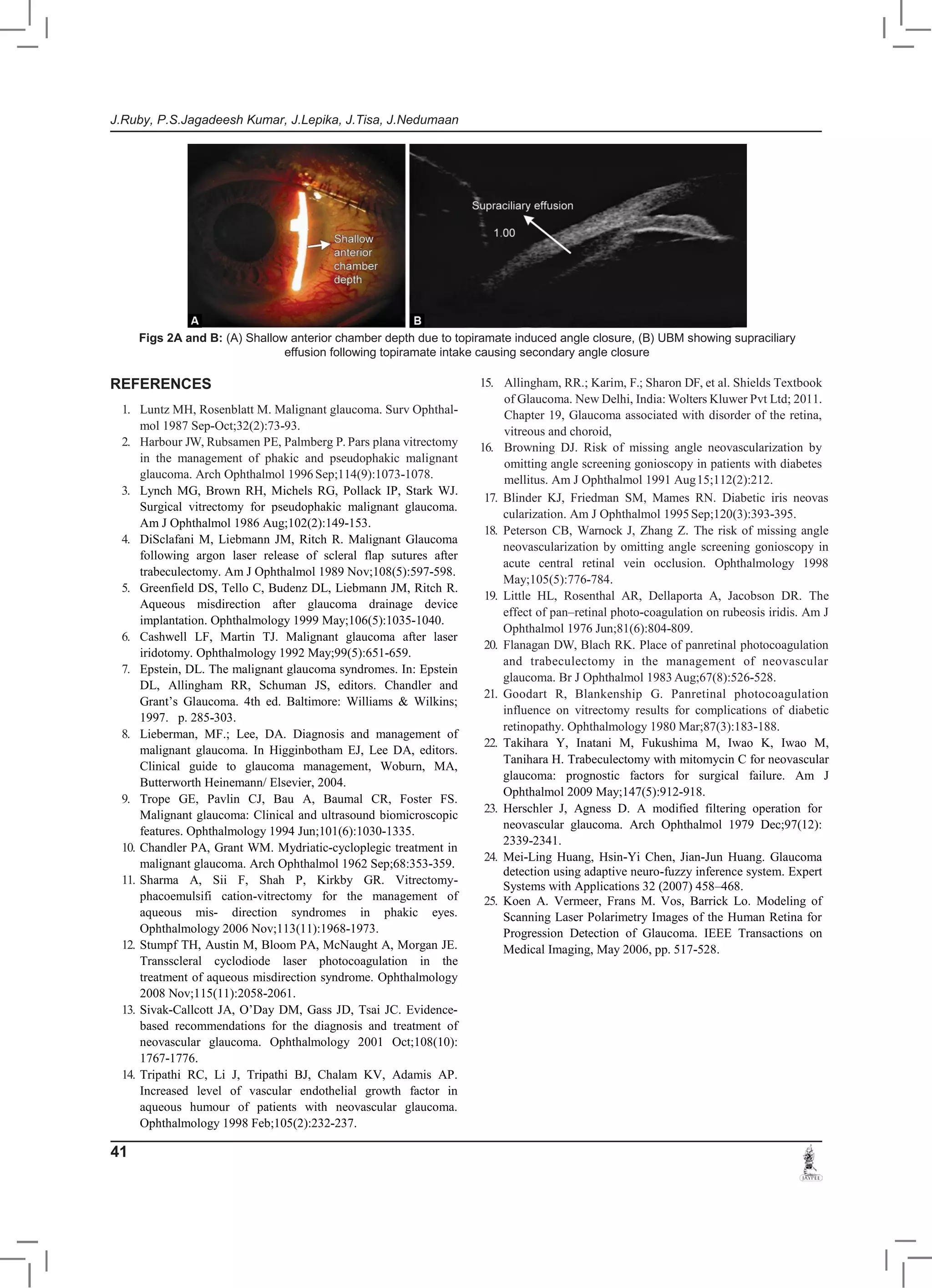 Glaucoma Detection And Image Processing Approaches A Review Pdf
