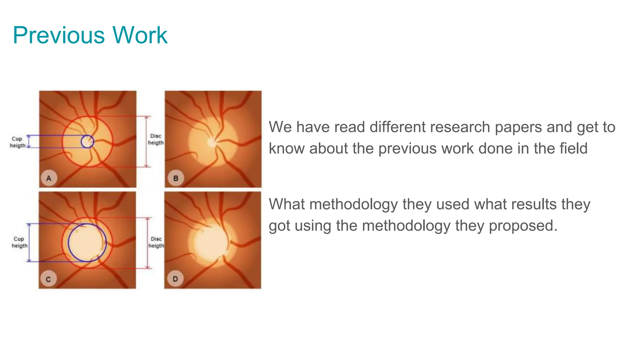 Glaucoma Detection using Deep Learning.pptx | Eye and Vision Conditions | Diseases and Conditions