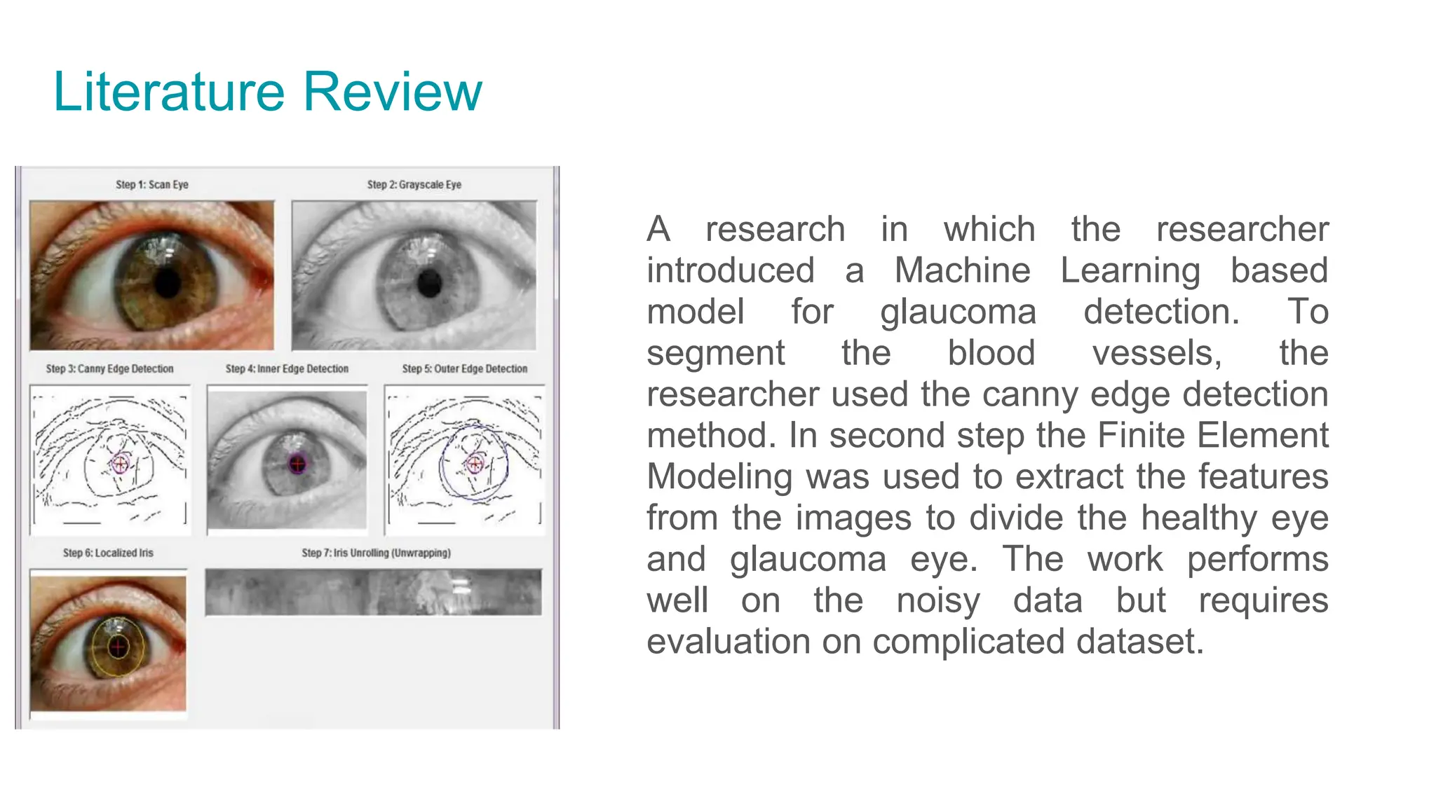 Glaucoma Detection using Deep Learning.pptx | Eye and Vision Conditions | Diseases and Conditions
