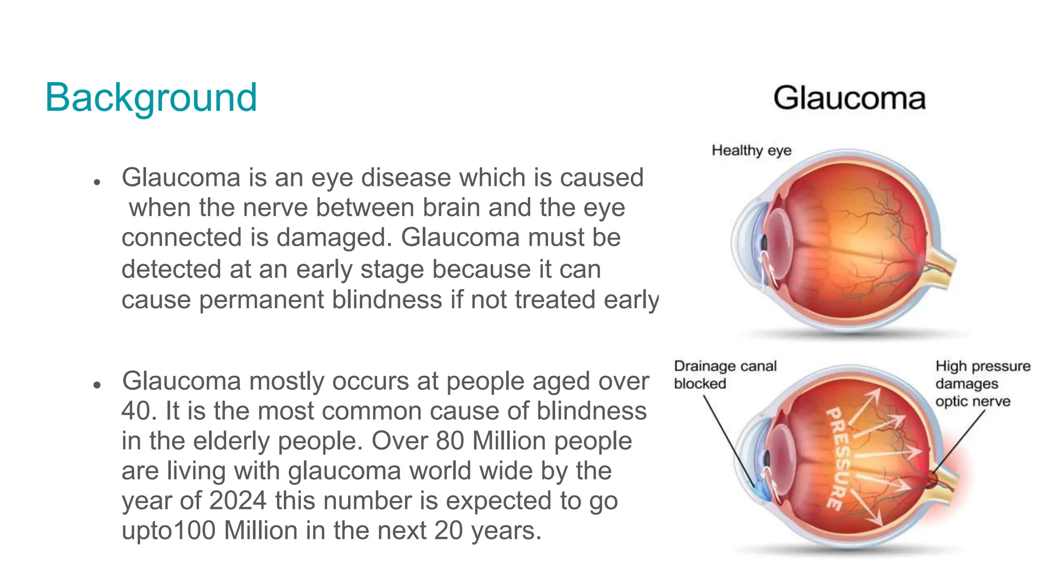 Glaucoma Detection using Deep Learning.pptx | Eye and Vision Conditions | Diseases and Conditions