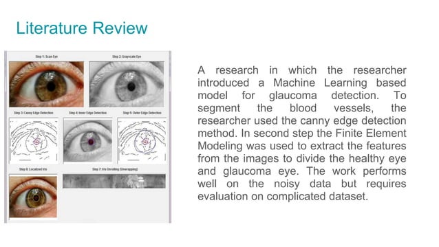 Glaucoma Detection using Deep Learning.pptx | Eye and Vision Conditions | Diseases and Conditions