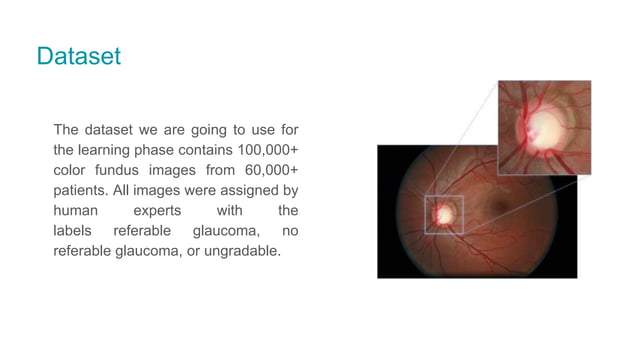 Glaucoma Detection Using Deep Learningpptx Eye And Vision Conditions