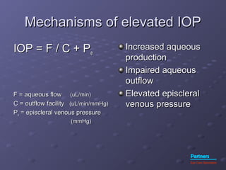 Glaucoma dr.gosiengfiao dr.pangalanan | PPT