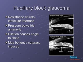 Glaucoma dr.gosiengfiao dr.pangalanan | PPT