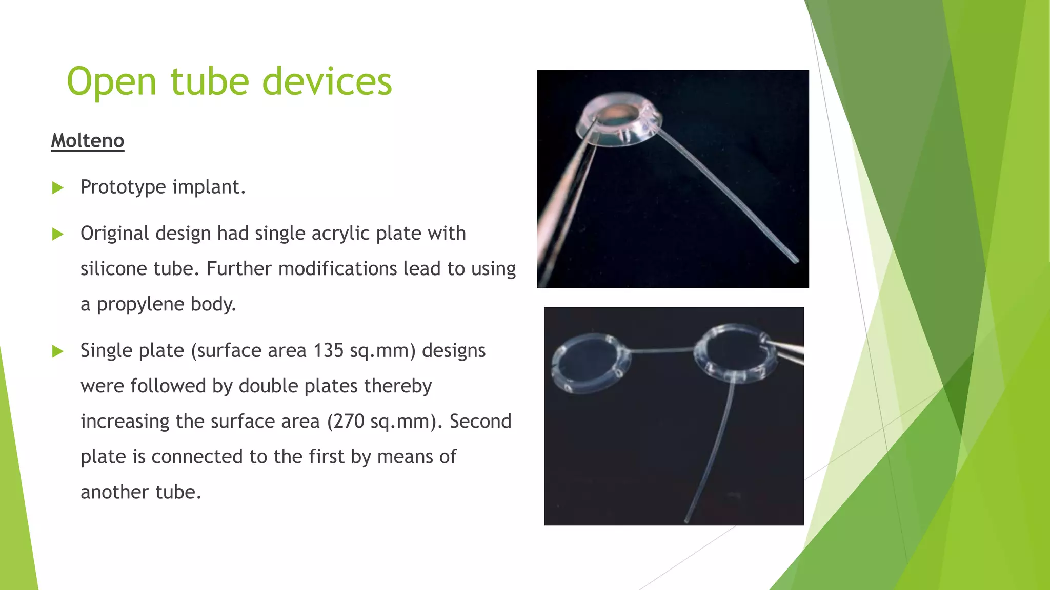Glaucoma drainage devices | PPTX