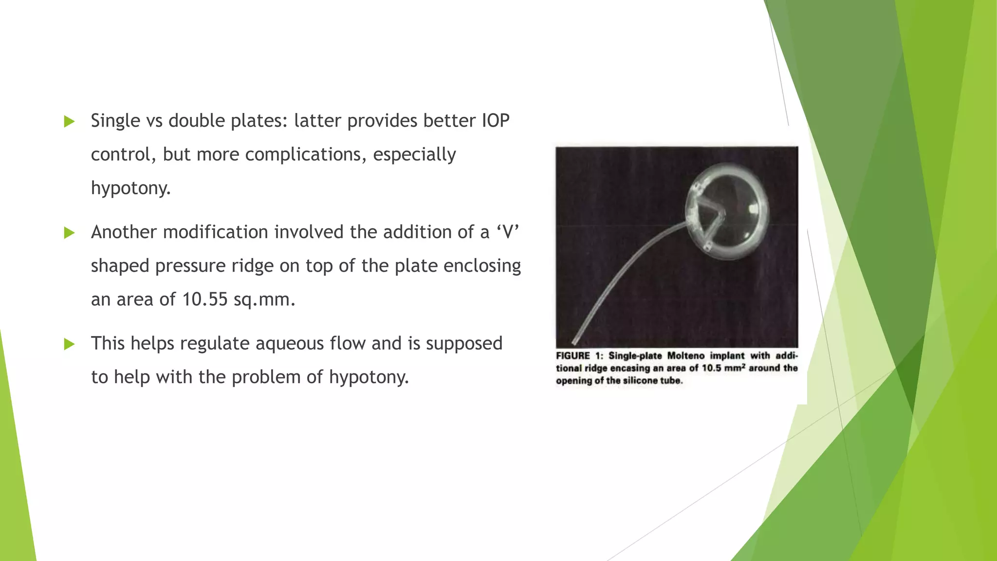 Glaucoma drainage devices | PPTX