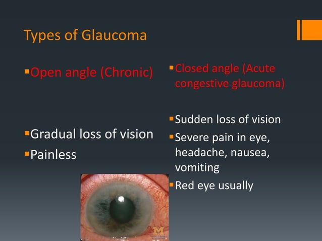 Pharmacology of glaucoma slideshare.pptx. | PPTX | Eye and Vision ...