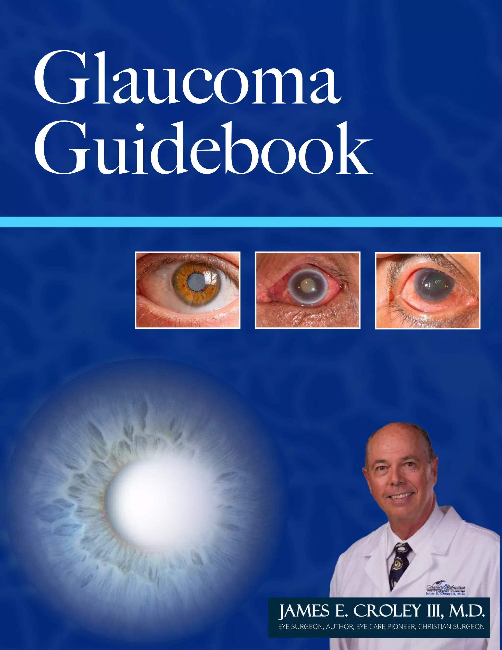 Glaucoma Guidebook by James E. Croley III, M.D..pdf