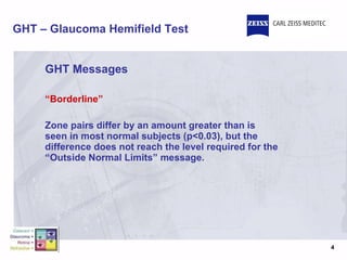 Glaucoma hemifield test | PPS
