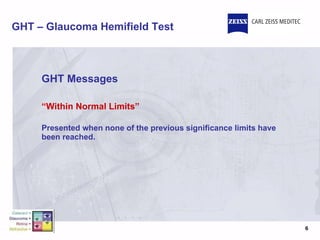 Glaucoma hemifield test | PPS