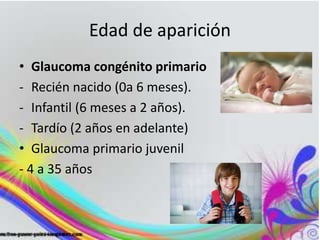 Glaucoma infantil 2016 (1) | PPTX
