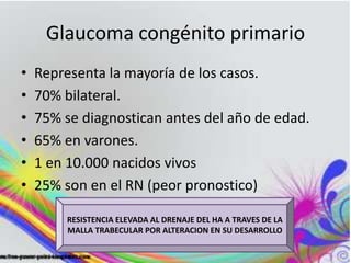 Glaucoma infantil 2016 (1) | PPTX