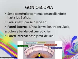 Glaucoma infantil 2016 (1) | PPTX