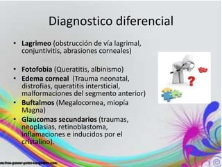 Glaucoma infantil 2016 (1) | PPTX