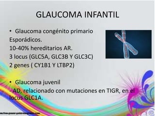 Glaucoma infantil 2016 (1) | PPTX