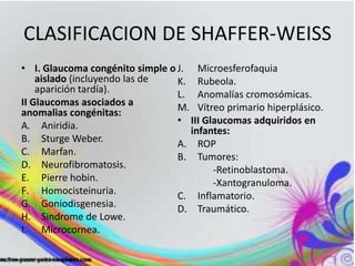 Glaucoma infantil 2016 (1) | PPTX