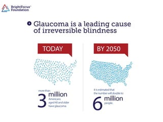 Save Your Sight From Glaucoma | PPTX