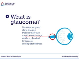 Save Your Sight From Glaucoma | PPTX