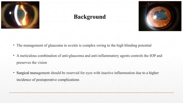 Glaucoma in uveitis , blindness, autoimmune 1.pptx