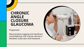 Glaucoma - Types and Clinical symptoms. Ophthalmology | PPTX