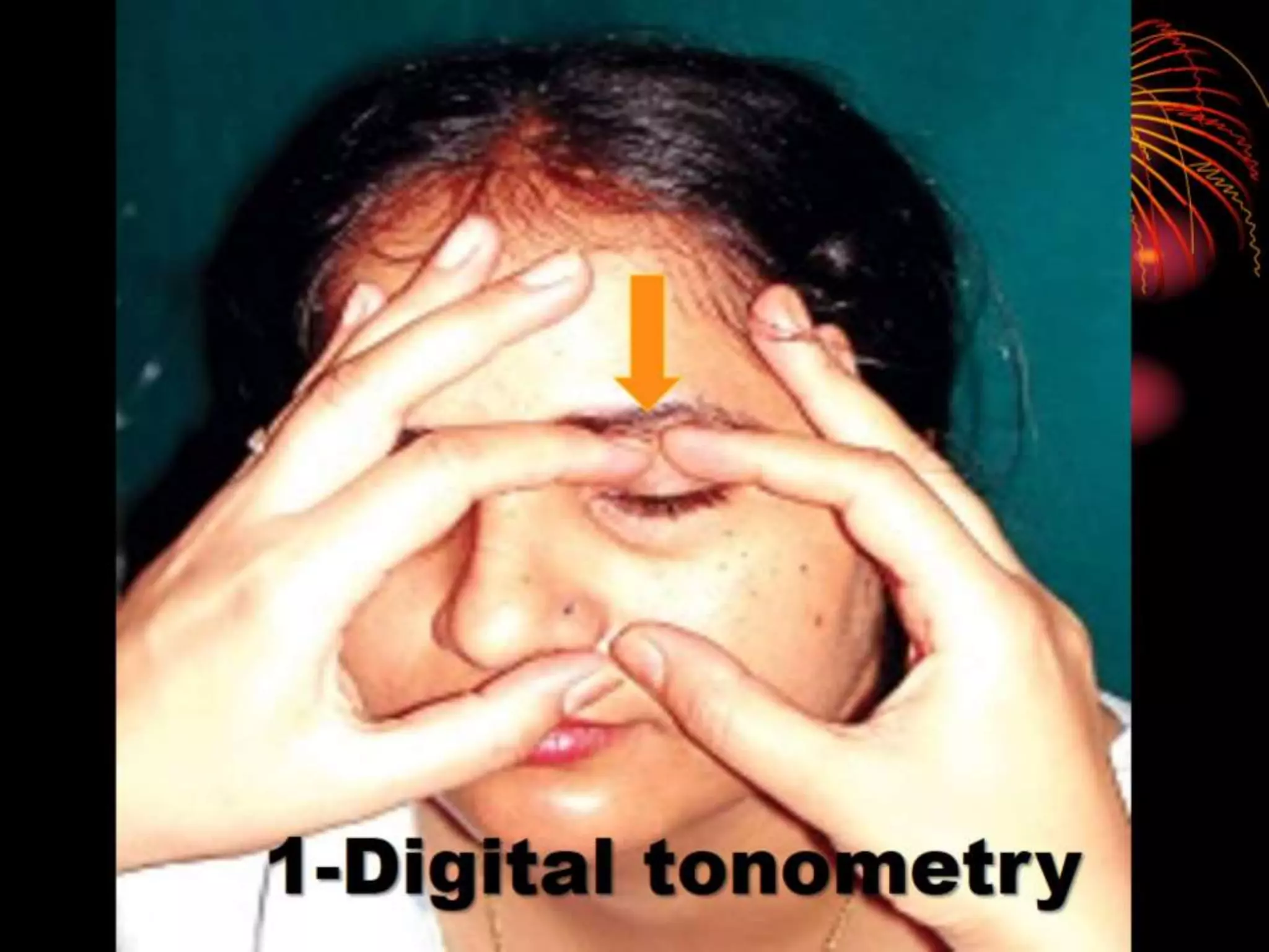Glaucoma lecture pict by dr abdul basir safi | PPT