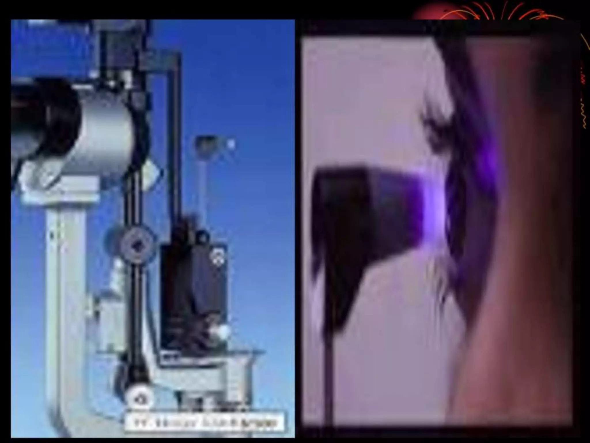 Glaucoma lecture pict by dr abdul basir safi | PPT