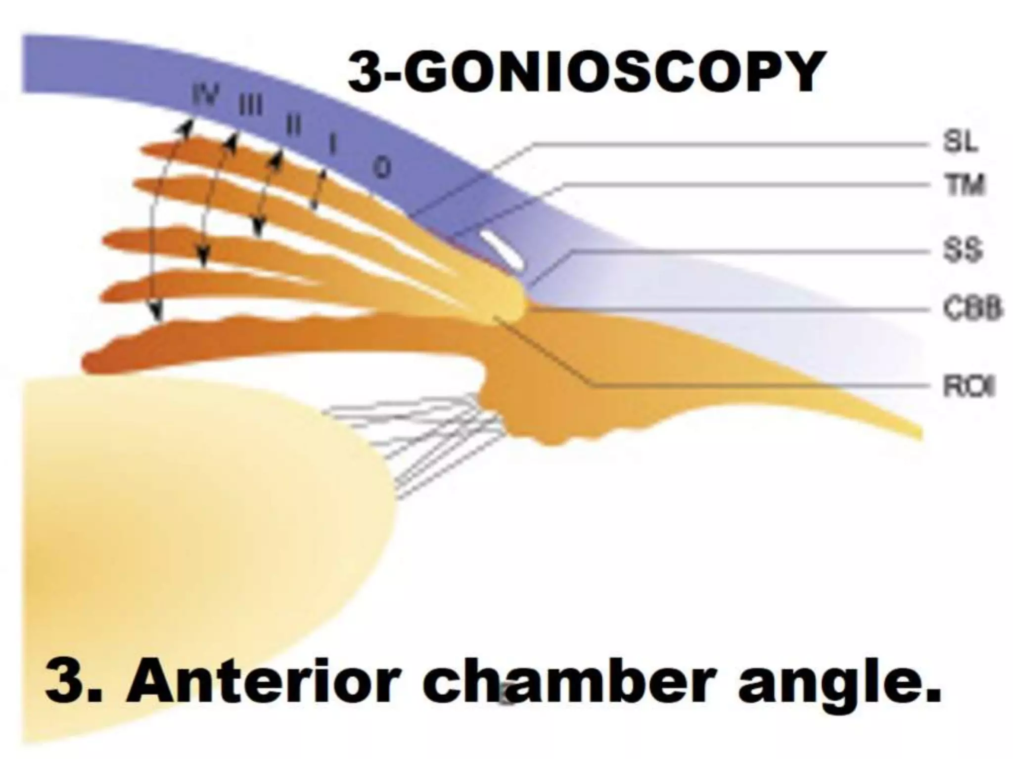 Glaucoma lecture pict by dr abdul basir safi | PPT