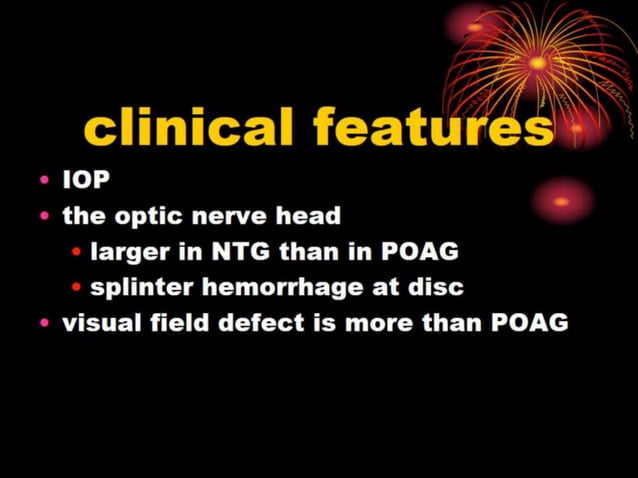 Glaucoma lecture pict by dr abdul basir safi | PPT