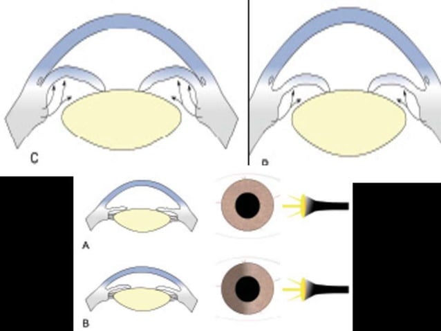 Glaucoma lecture pict by dr abdul basir safi | PPT