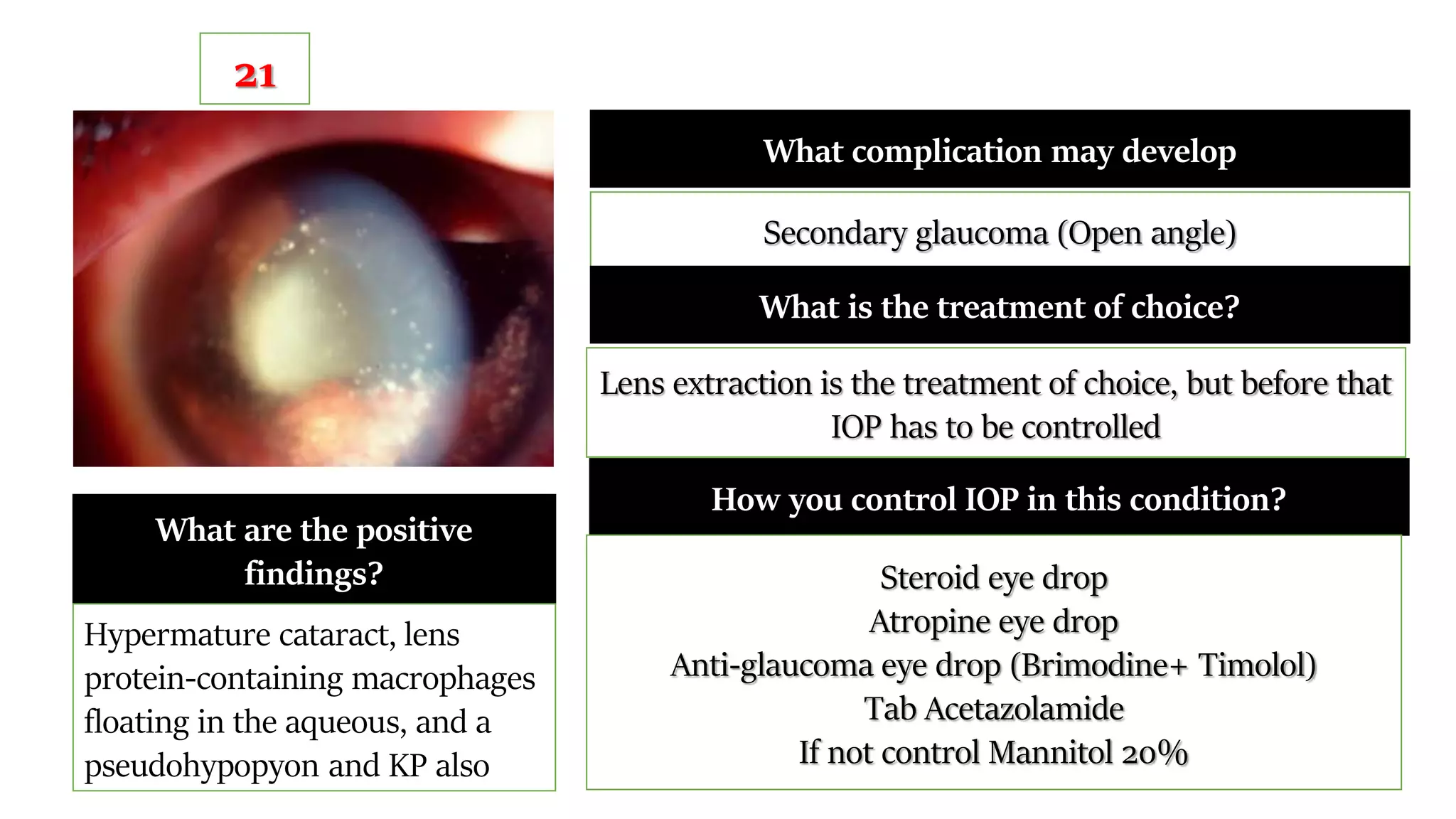 Glaucoma & lens | PPTX