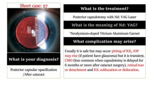 Glaucoma & lens | PPTX