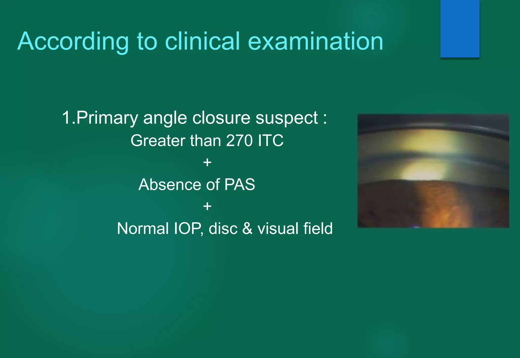 Glaucoma management paradigms | PPTX